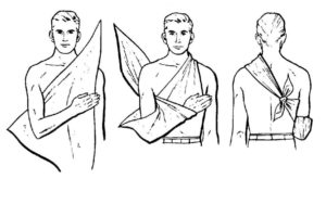 What is a Triangular Bandage (Cravat)? How to make and use one.